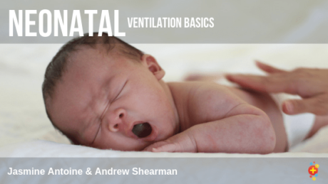 A Cheat Sheet For Neonatal Invasive Ventilation – BDNE