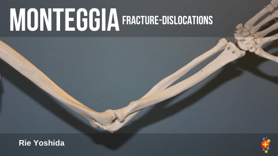 Monteggia fracture dislocations