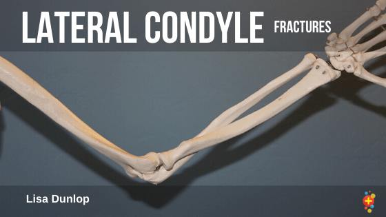 Lateral condylar fractures of the humerus
