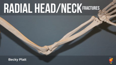 Radial head and neck fractures