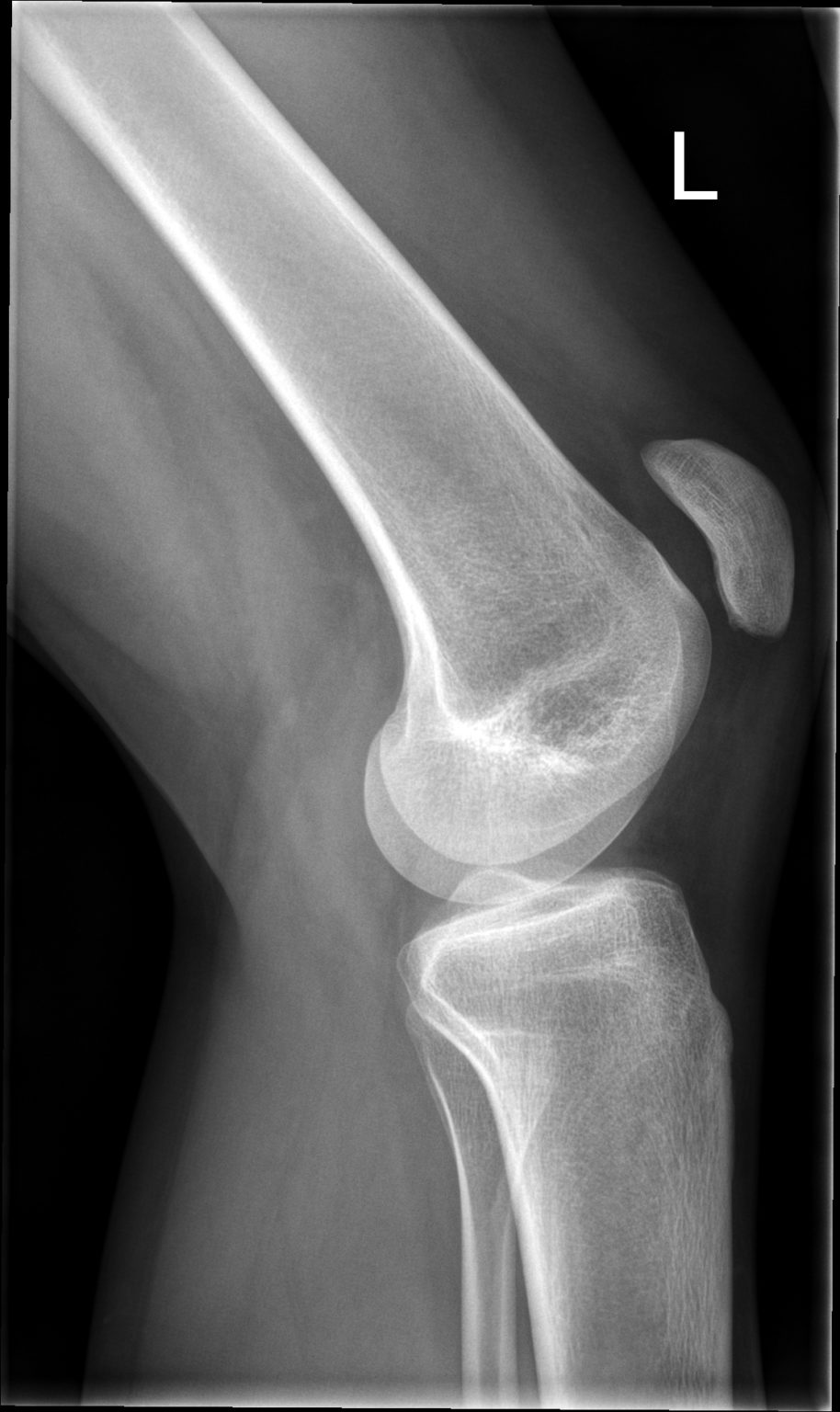 All Things Patella