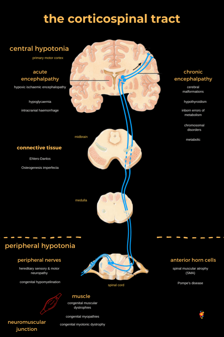 An approach to the floppy infant