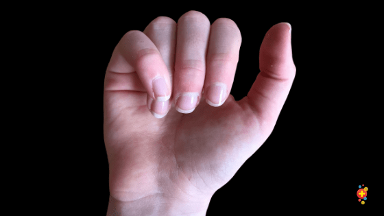 Finger injuries: basics and bones - Don't Forget the Bubbles