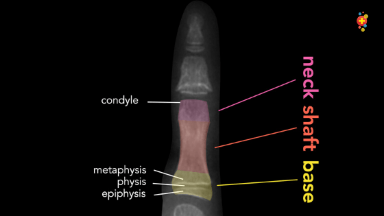 Finger injuries: basics and bones - Don't Forget the Bubbles