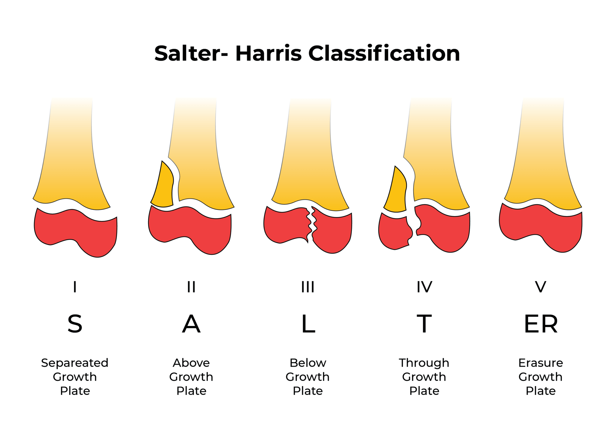 Classification Of Wrist Fractures At Joseph Dearth Blog