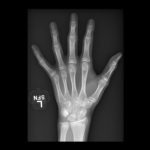 Wrist x-rays