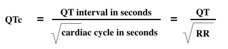 Ten ‘not to be missed’ paediatric ECGs
