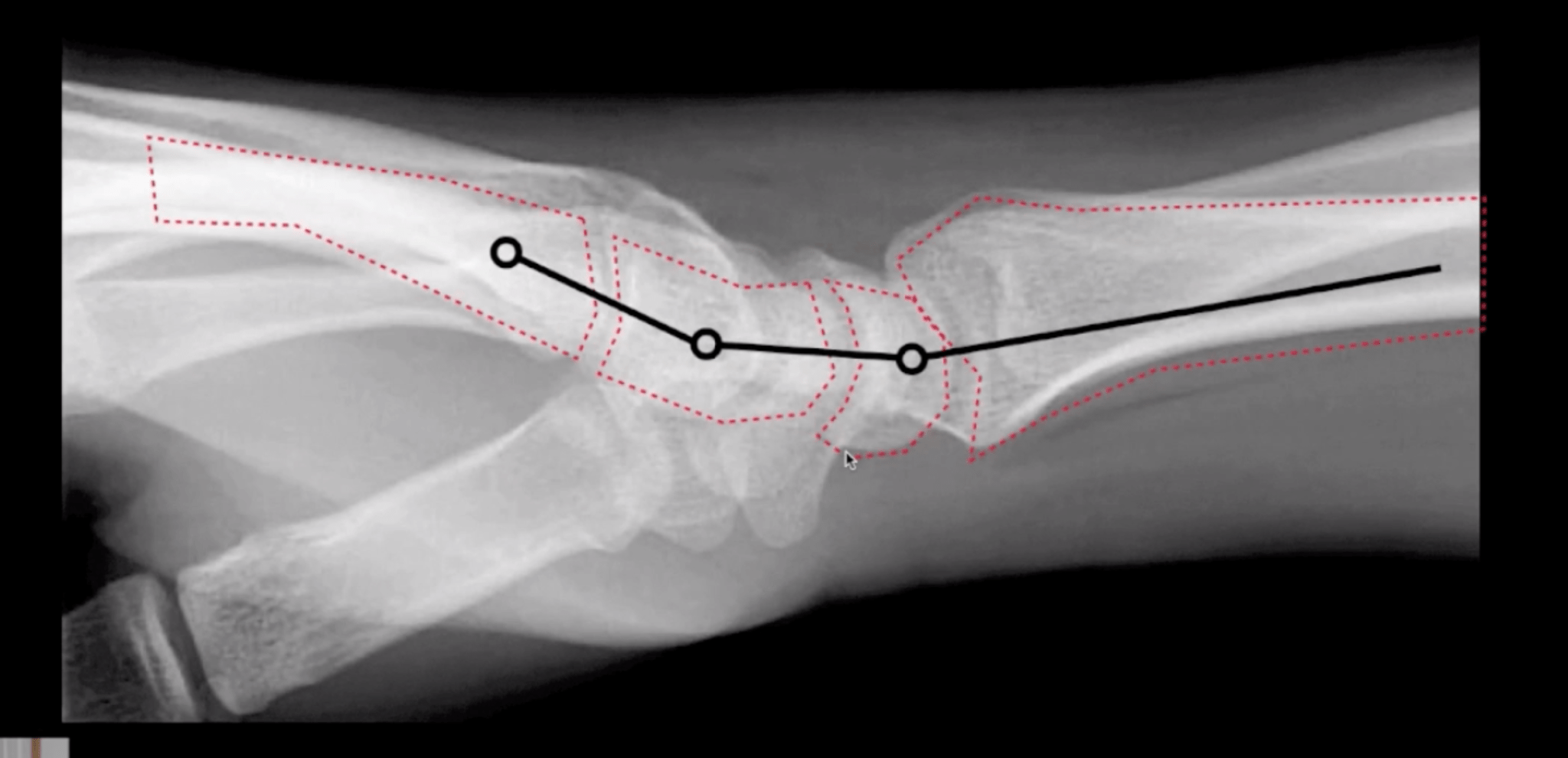 Wrist Examination & Pathology Module