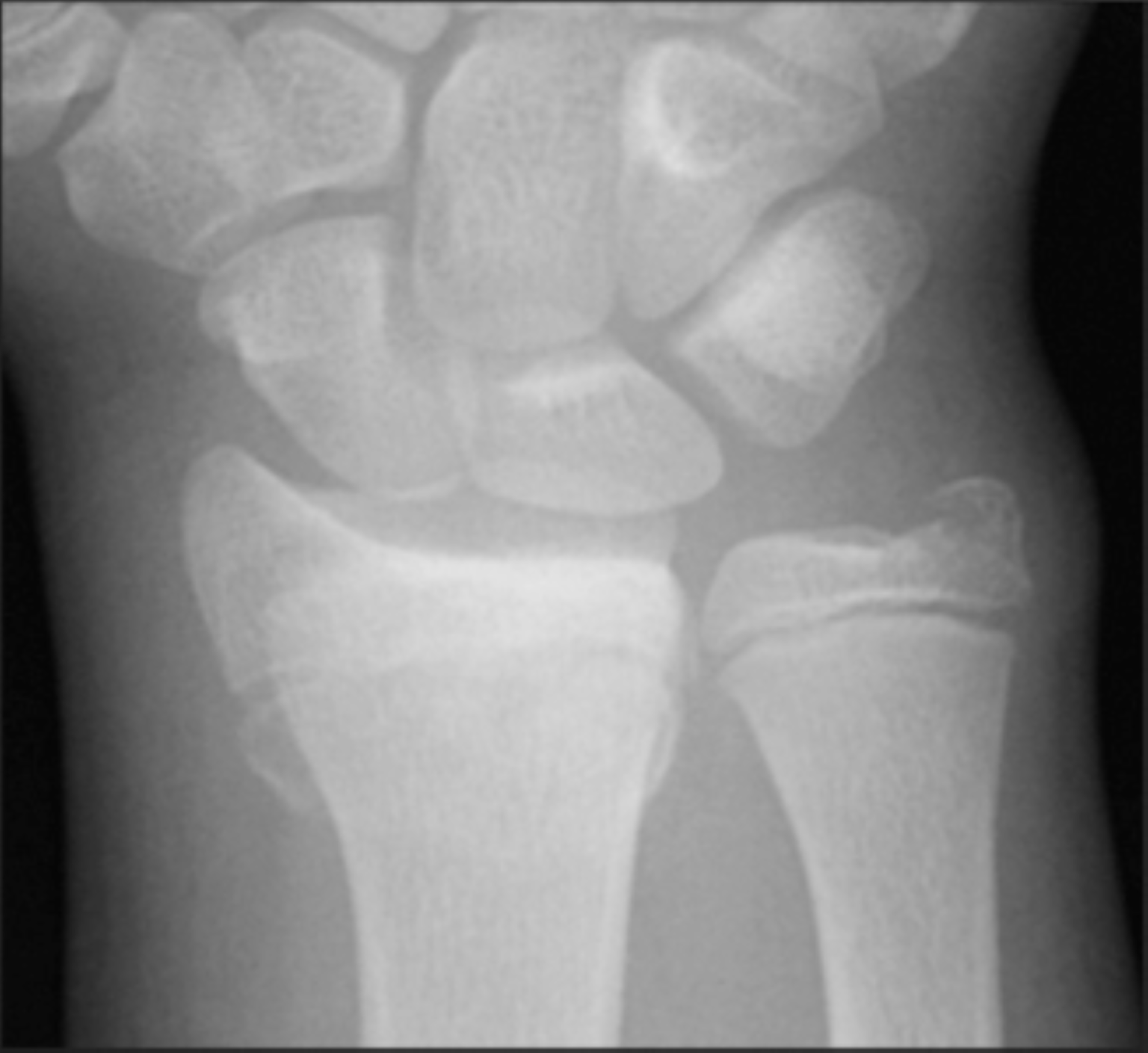 Wrist Examination & Pathology Module
