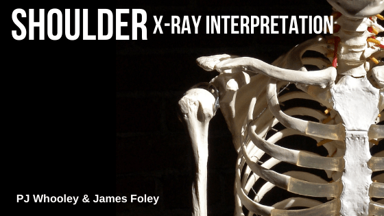Shoulder x-ray interpretation