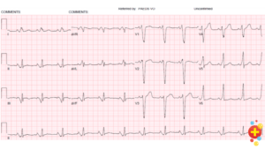 Ten ‘not to be missed’ paediatric ECGs