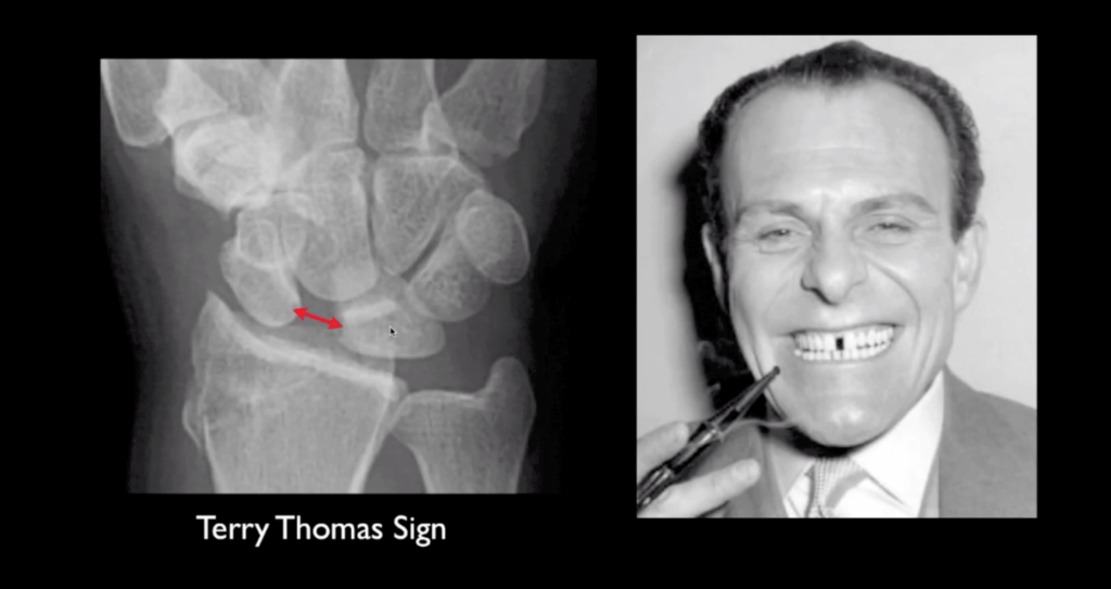 Wrist Examination & Pathology Module