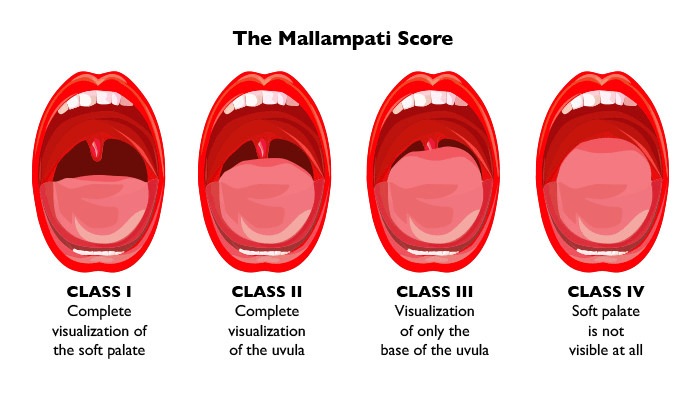 Rapid Sequence Induction and the Difficult Airway Module