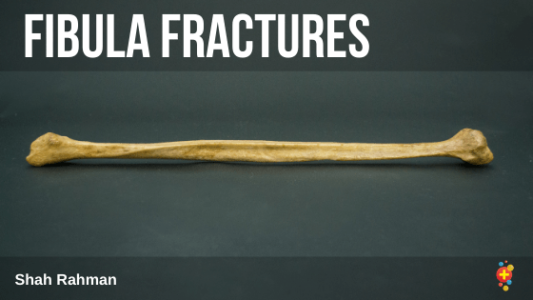 Fibula fractures