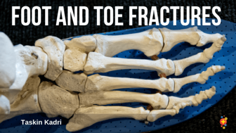 Foot and toe injuries