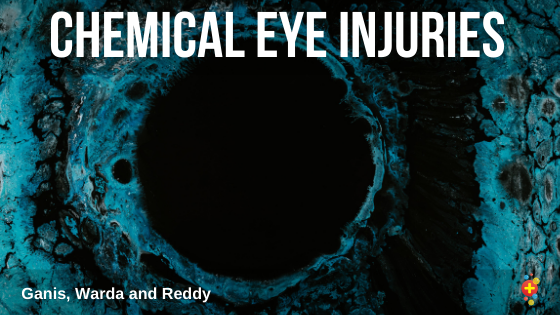 How to manage chemical eye injuries - Don't Forget the Bubbles