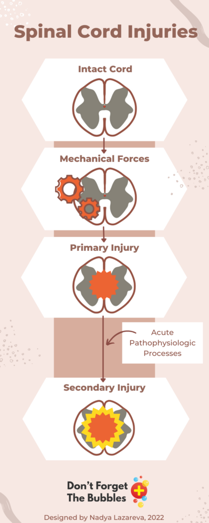 Spinal Cord Injuries - Don't Forget the Bubbles