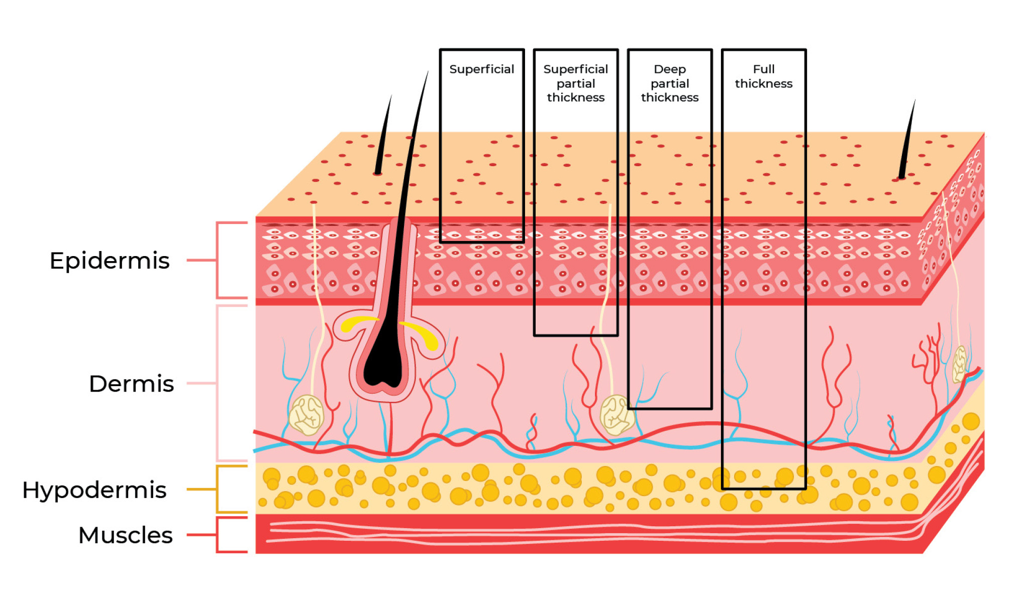 Burns Module - Don't Forget the Bubbles