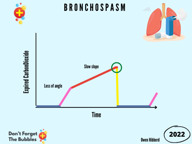 A Beginner's Guide to Capnography - Don't Forget the Bubbles