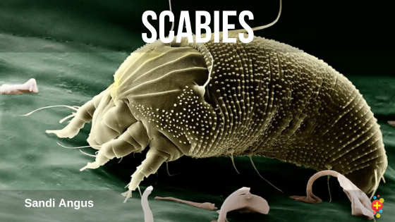 Scabies Bug Scabies: Refine Your Exam, Avoid These Diagnostic Pitfalls